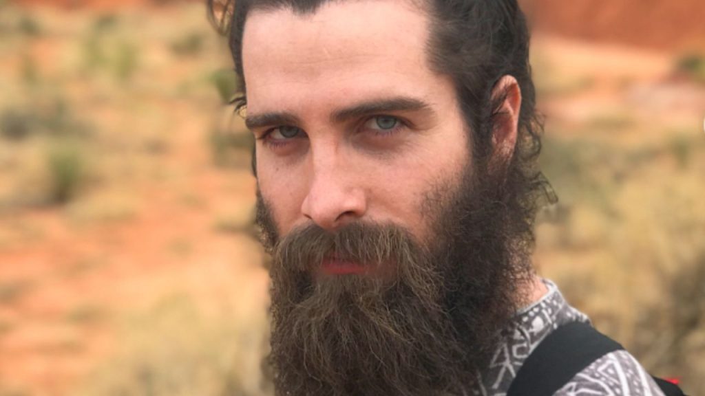 Luca Sguazzini, il messaggio dopo l'ischemia: "Sto combattendo"
